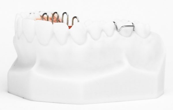 Tongue Crib – BM Ortho Appliances Inc.