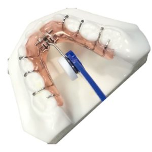 Schwartz Expander Upper – Lower – BM Ortho Appliances Inc.