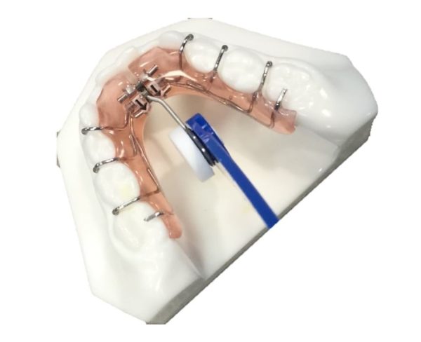 Schwartz Expander Upper – Lower – BM Ortho Appliances Inc.