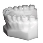 Fixed Bonded Retainer Upper – Lower – BM Ortho Appliances Inc.