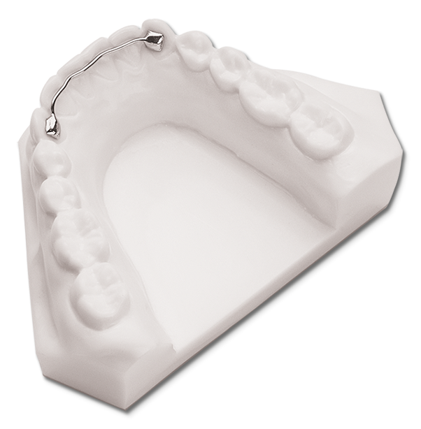 Nance Appliance – BM Ortho Appliances Inc.