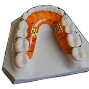 Unilateral Expander Upper – Lower – BM Ortho Appliances Inc.