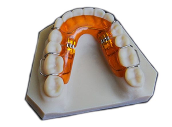 Unilateral Expander Upper – Lower – BM Ortho Appliances Inc.