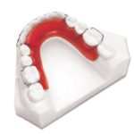 Hawley Retainer Upper – Lower – BM Ortho Appliances Inc.