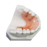 Hawley Retainer Upper – Lower – BM Ortho Appliances Inc.