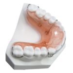 Hawley Retainer Upper – Lower – BM Ortho Appliances Inc.