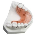 Hawley Retainer Upper – Lower – BM Ortho Appliances Inc.