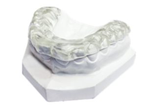 Acrylic Cross-bite – BM Ortho Appliances Inc.