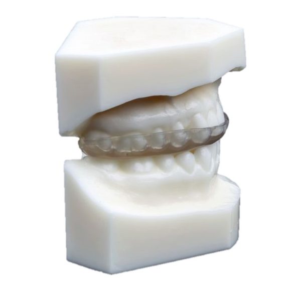 Flat Occlusal Splint – BM Ortho Appliances Inc.