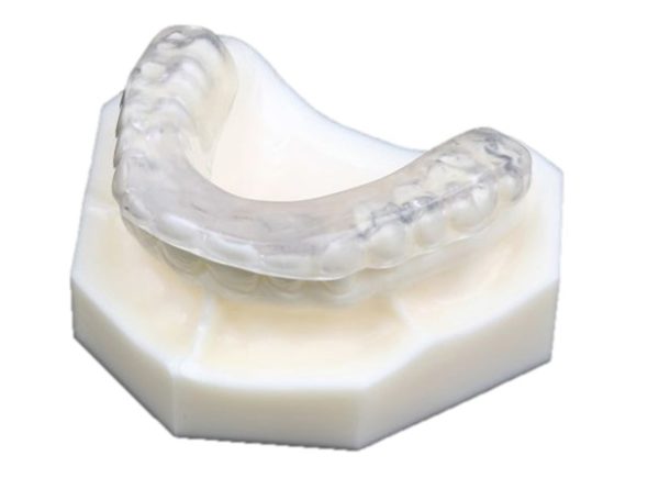 Flat Occlusal Splint – BM Ortho Appliances Inc.