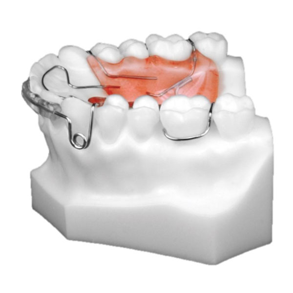 Open Spring Retainer – Upper – BM Ortho Appliances Inc.