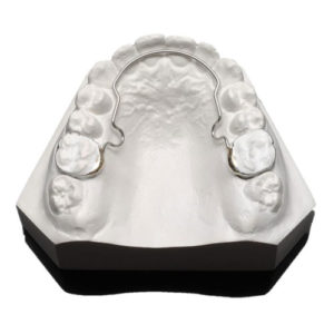 Passive Lingual Arch – BM Ortho Appliances Inc.