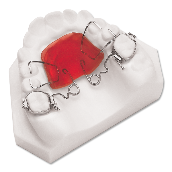 Hilgers Pendulum Appliance – BM Ortho Appliances Inc.