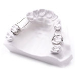 Band and Loop Space Maintainer – BM Ortho Appliances Inc.