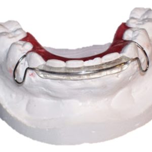 Spring Aligner with Acrylic Extension – BM Ortho Appliances Inc.