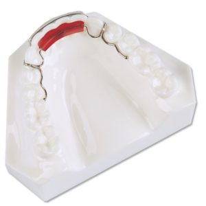 Spring Aligner with wire extension – BM Ortho Appliances Inc.