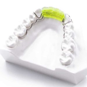 Spring Aligner with wire extension – BM Ortho Appliances Inc.