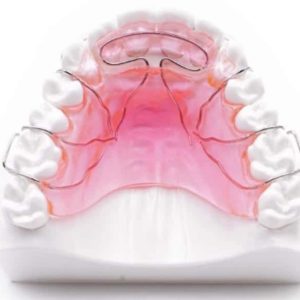 Super Spring Aligner – BM Ortho Appliances Inc.