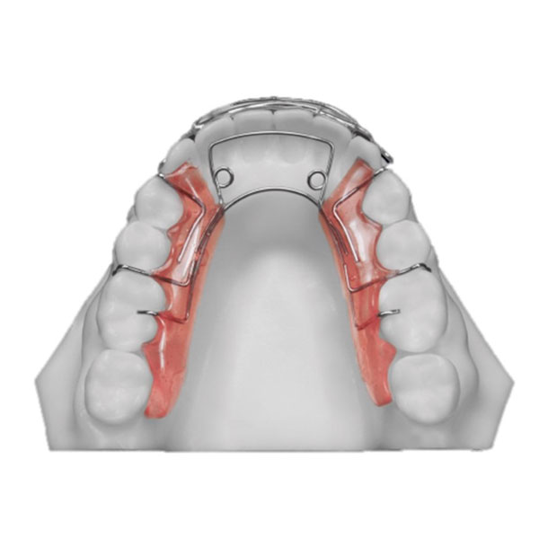 Premand Spring Retainer – BM Ortho Appliances Inc.