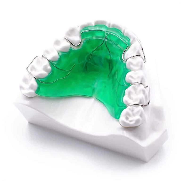 Spring Aligner – BM Ortho Appliances Inc.