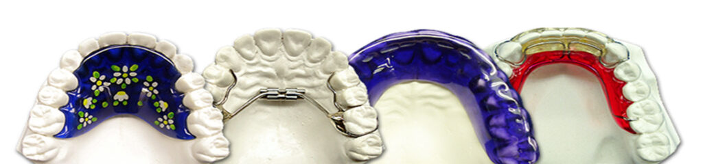 AccessoriesClasps in Removable Orthodontics – BM Ortho Appliances Inc.